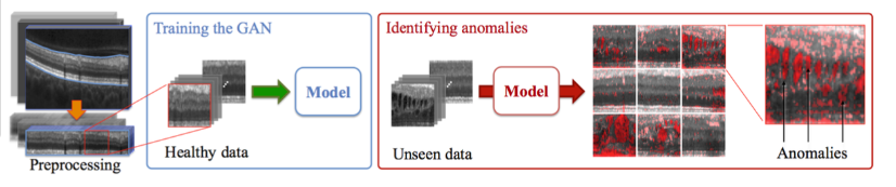 GitHub - sangjun97/Anormaly-detection-AI-models