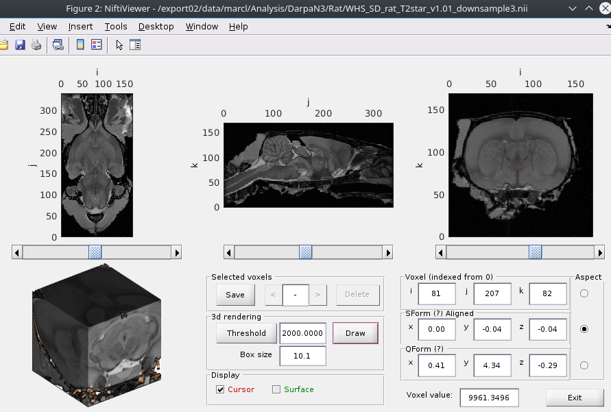 MRI viewer offset · Issue #263 · brainstorm-tools/brainstorm3 · GitHub