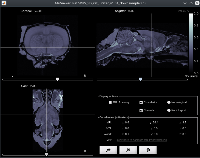 MRI viewer offset · Issue #263 · brainstorm-tools/brainstorm3 · GitHub