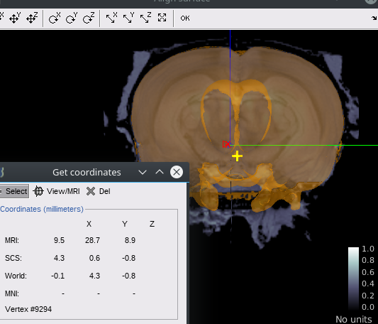 MRI viewer offset · Issue #263 · brainstorm-tools/brainstorm3 · GitHub