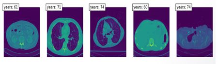 GitHub - isoumikm/Classification-CT-Scan-Images-Age-and-Contrast-CNN: A ...