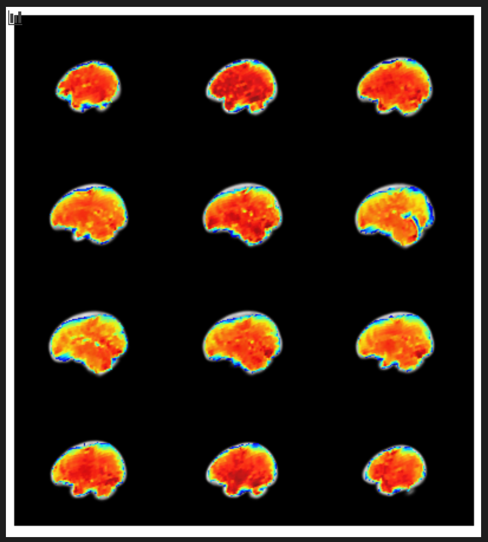 Strange Concatenated Registration using BOLD (4D) · Issue #269 · ANTsX/ANTsPy · GitHub