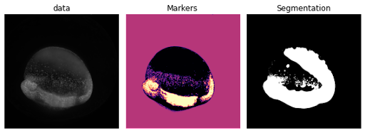 GitHub - ddeka99/cv-segmentation