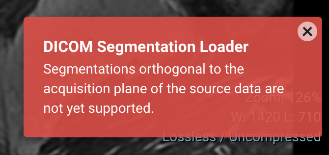 Segmentations fail to render · Issue #2656 · OHIF/Viewers · GitHub