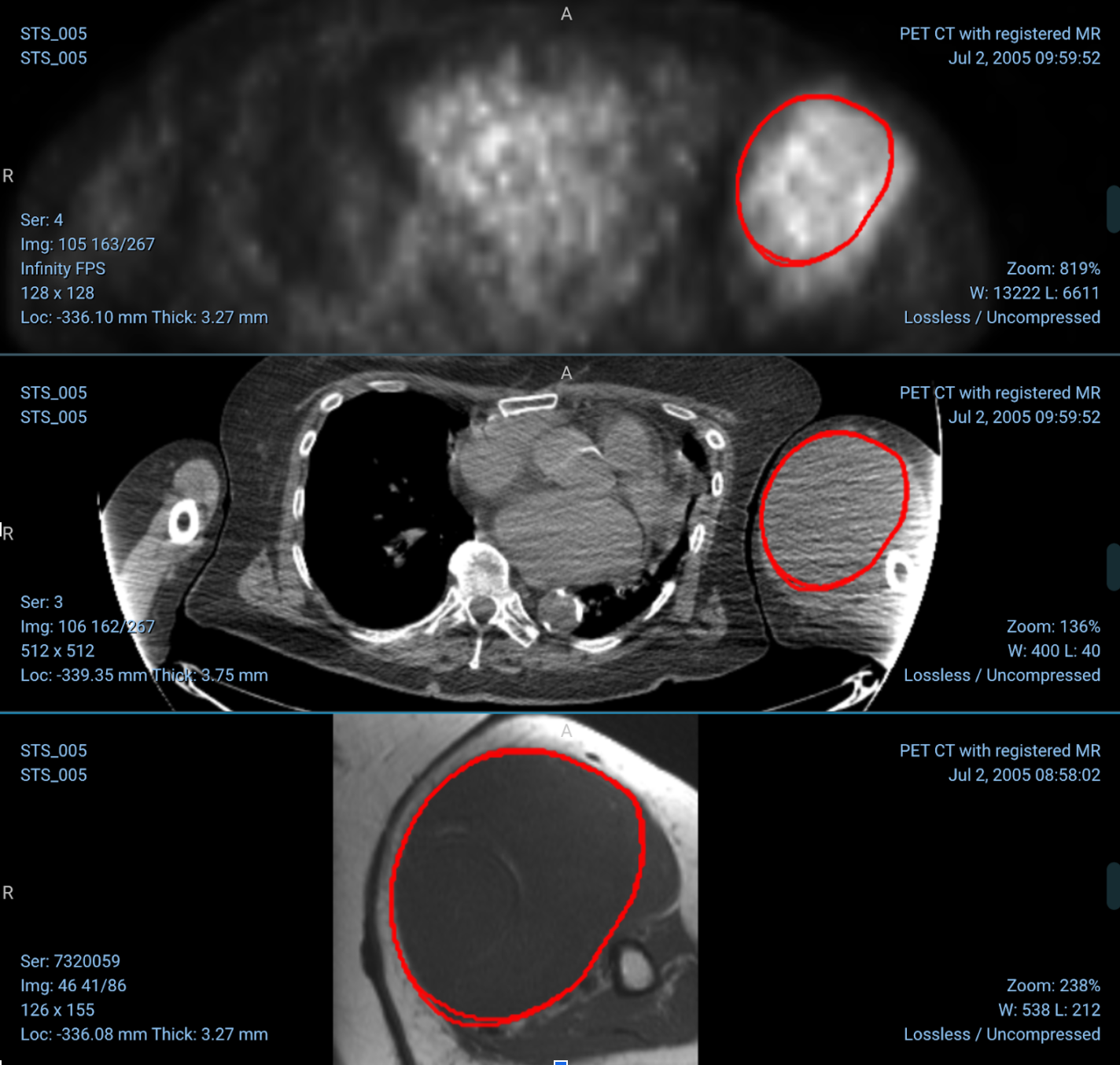 RTSTRUCT selection not available for series in a layout · Issue #2657 · OHIF/Viewers · GitHub
