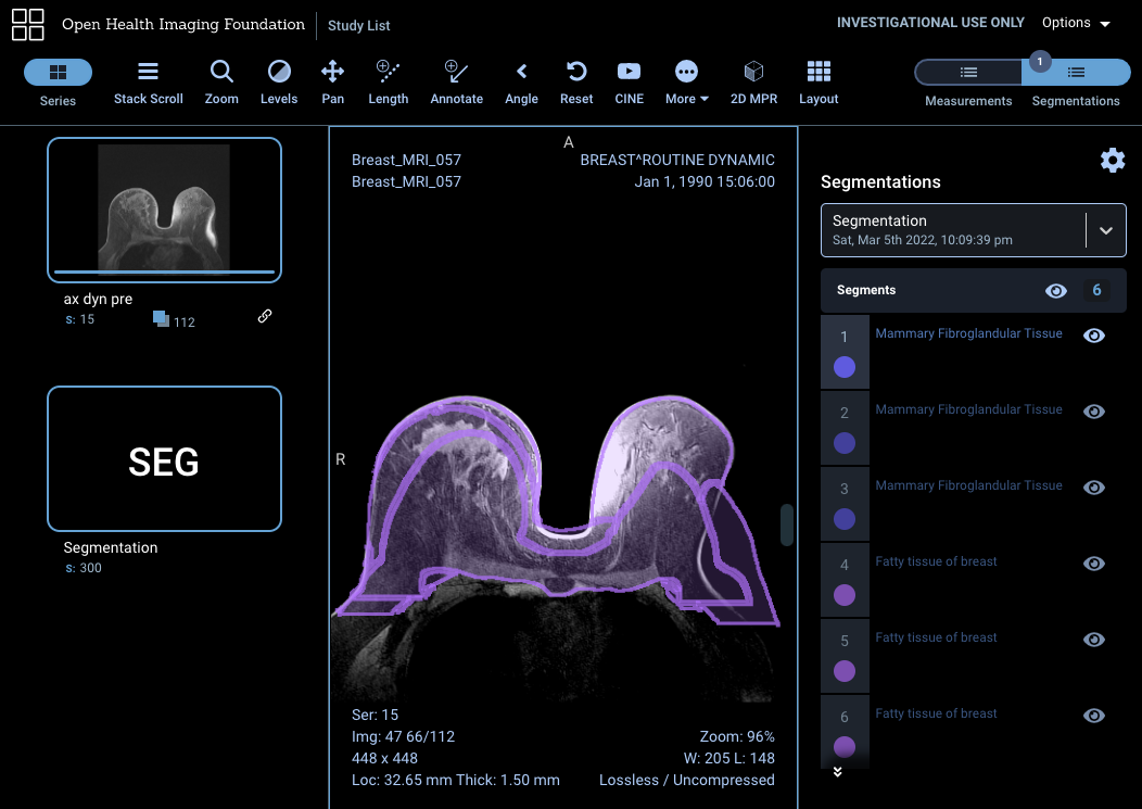 Incorrect handling of single-slice segmentations · Issue #2733 · OHIF/Viewers · GitHub