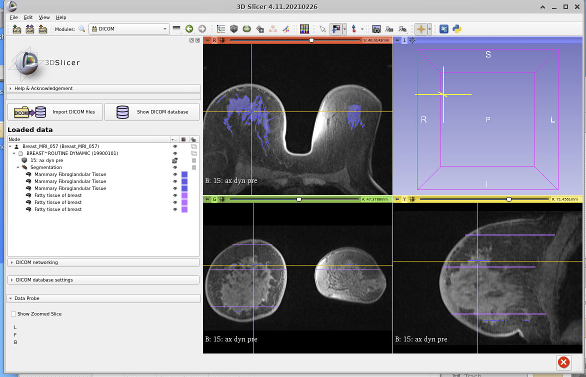Incorrect handling of single-slice segmentations · Issue #2733 · OHIF/Viewers · GitHub