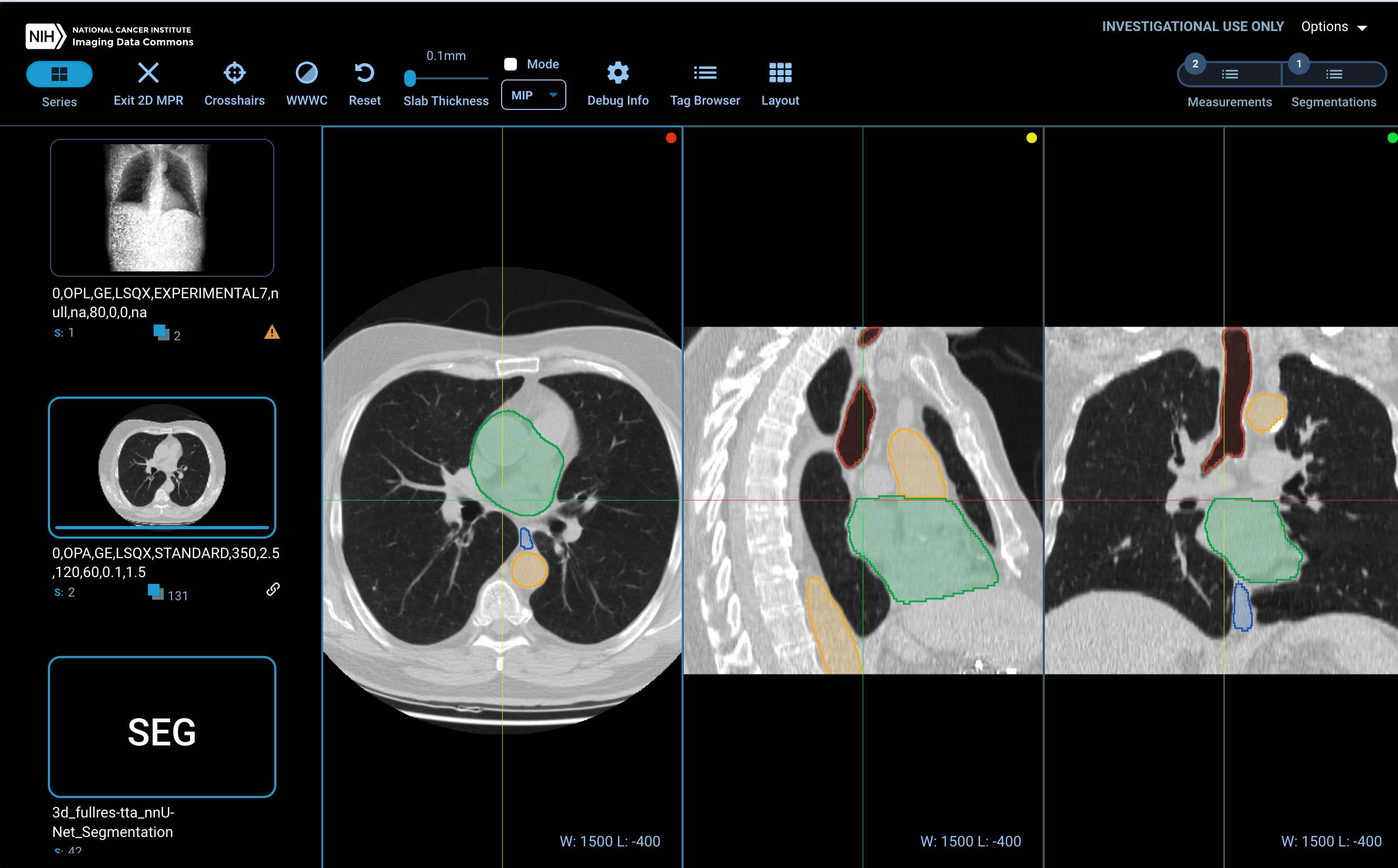 Segmentation layer add button is missing · Issue #512 · Kitware/VolView · GitHub