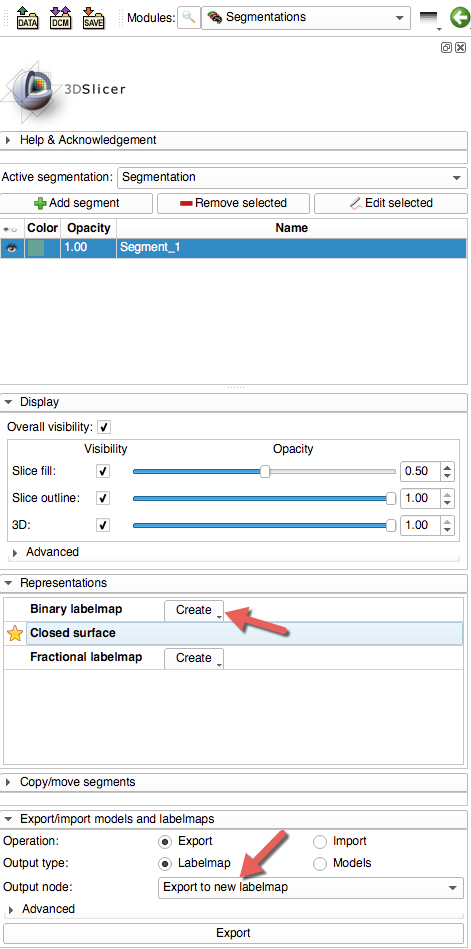 Using pyradiomics for shape feature extraction? · Issue #349 · AIM ...