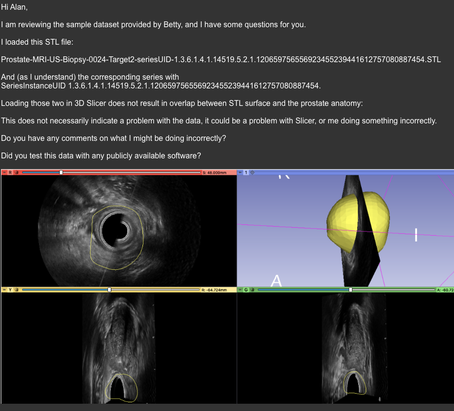 DICOM for STL segmentations for a new collection (prostate MR/US segmentations) · Issue #4 ...