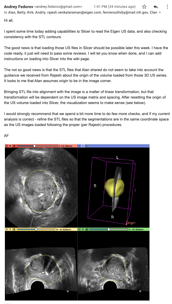 DICOM for STL segmentations for a new collection (prostate MR/US segmentations) · Issue #4 ...