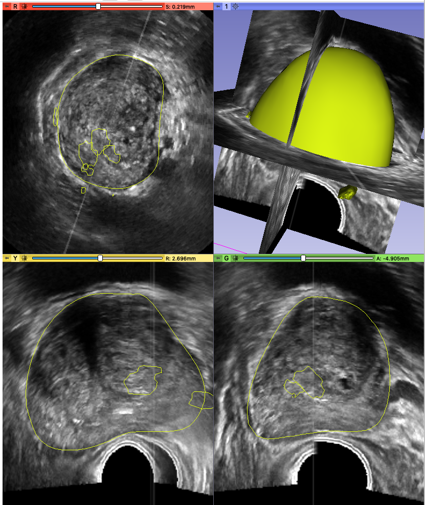 DICOM for STL segmentations for a new collection (prostate MR/US segmentations) · Issue #4 ...