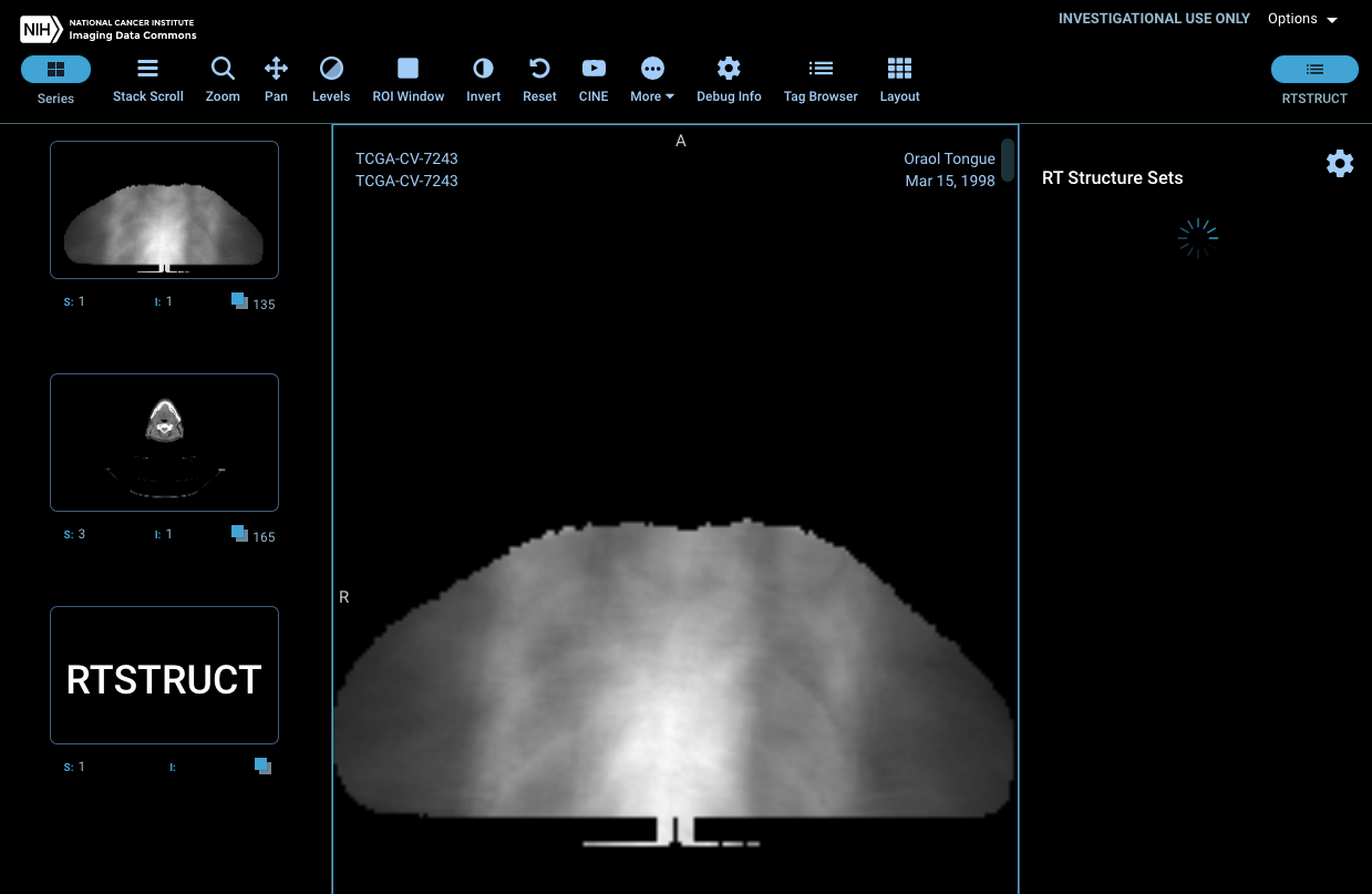 RTSTRUCT tab is shown when not applicable, does not load when opened · Issue #2117 · OHIF ...