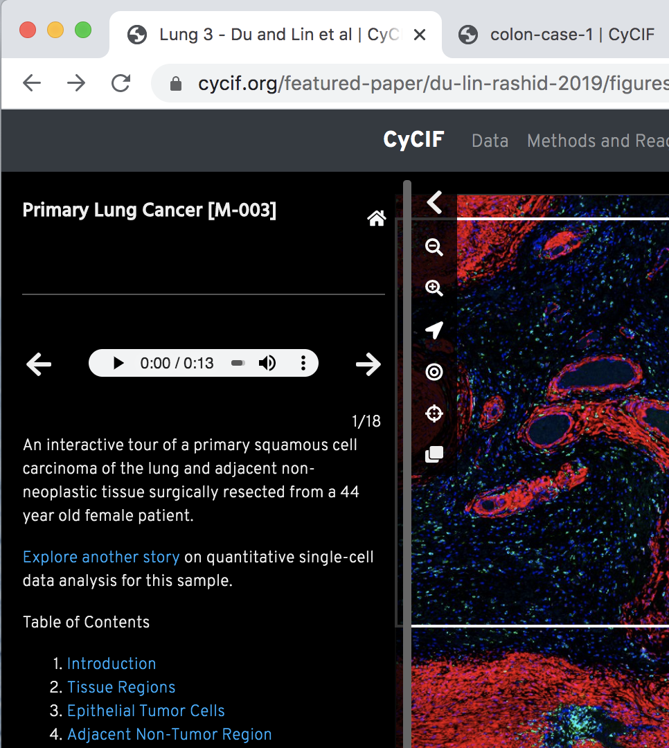 remove extra space in narration panel · Issue #37 · labsyspharm/minerva-story · GitHub