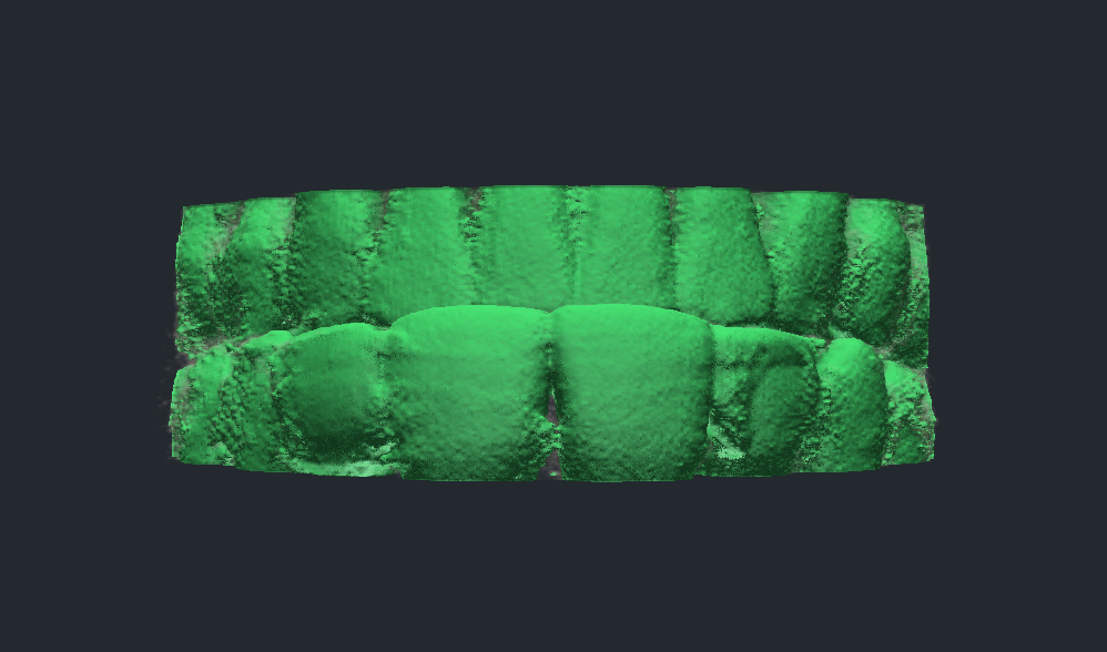 There Is A Dark Shadow On The Solid Surface · Issue 2772 · Kitware Vtk Js · Github