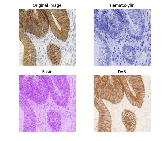 RGB to HED conversion after version 0.17 · Issue #5164 · scikit-image/scikit-image · GitHub