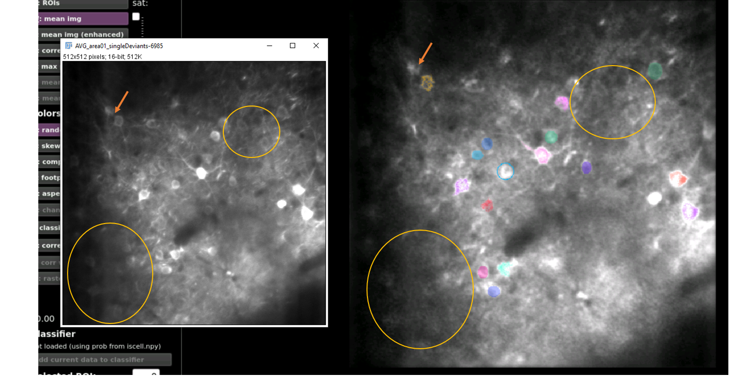 surprisingly bad cell detection for cortical imaging GCaMP7f · Issue #730 · MouseLand/suite2p ...