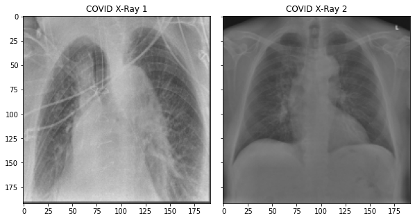 GitHub - melissafeeney/Deep-Learning-X-Ray-Classification