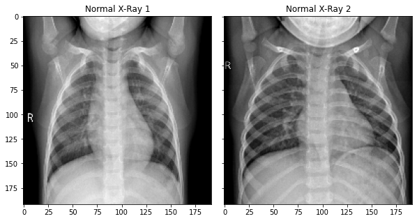 GitHub - melissafeeney/Deep-Learning-X-Ray-Classification