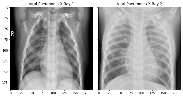 GitHub - melissafeeney/Deep-Learning-X-Ray-Classification