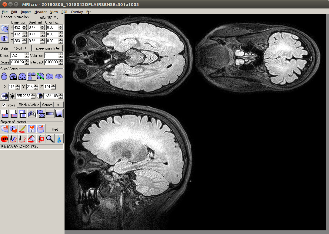 Slice orientation · Issue #217 · rordenlab/dcm2niix · GitHub
