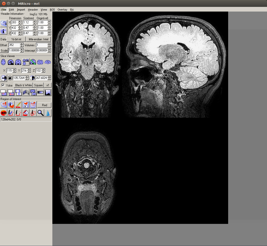 Slice orientation · Issue #217 · rordenlab/dcm2niix · GitHub