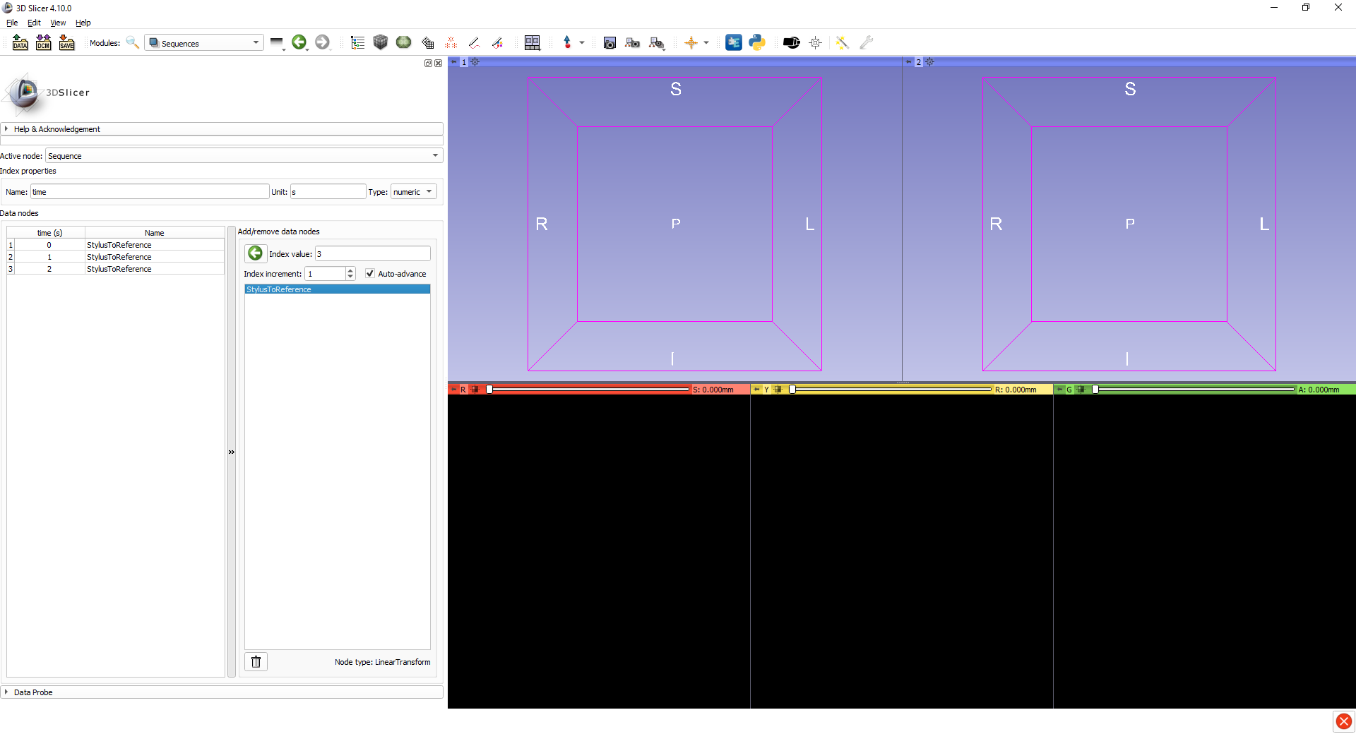 simple surface reconstruction using a tracker · Issue #473 · PlusToolkit/PlusLib · GitHub