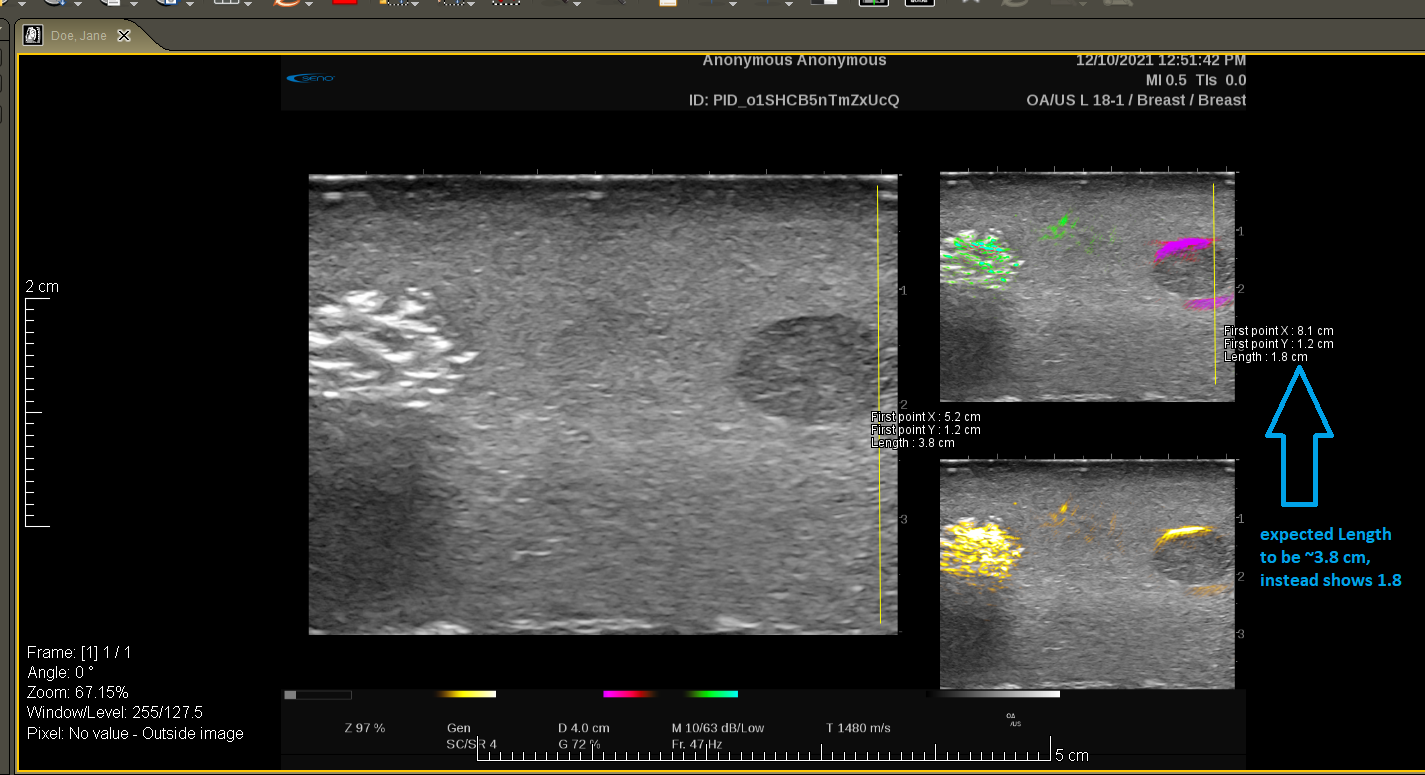 Support measurement computations across Ultrasound regions with different scale factors · Issue ...