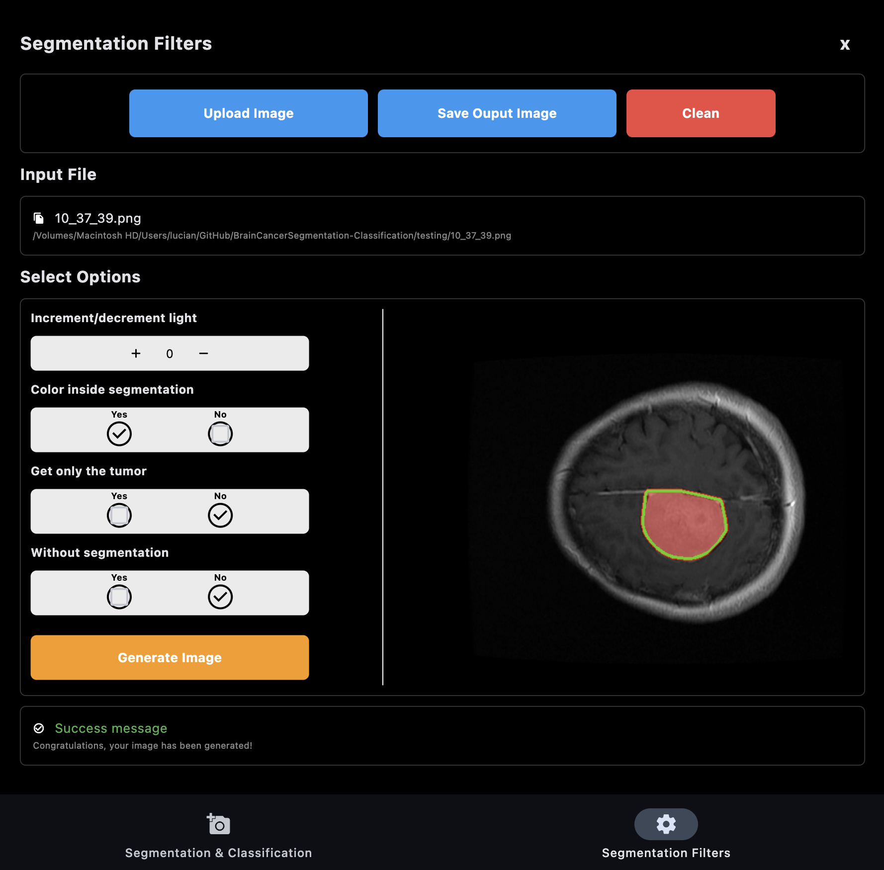 GitHub - davidebelcastro-sig/BrainCancerSegmentation-Classification: 🎓 My BSc Thesis and ...