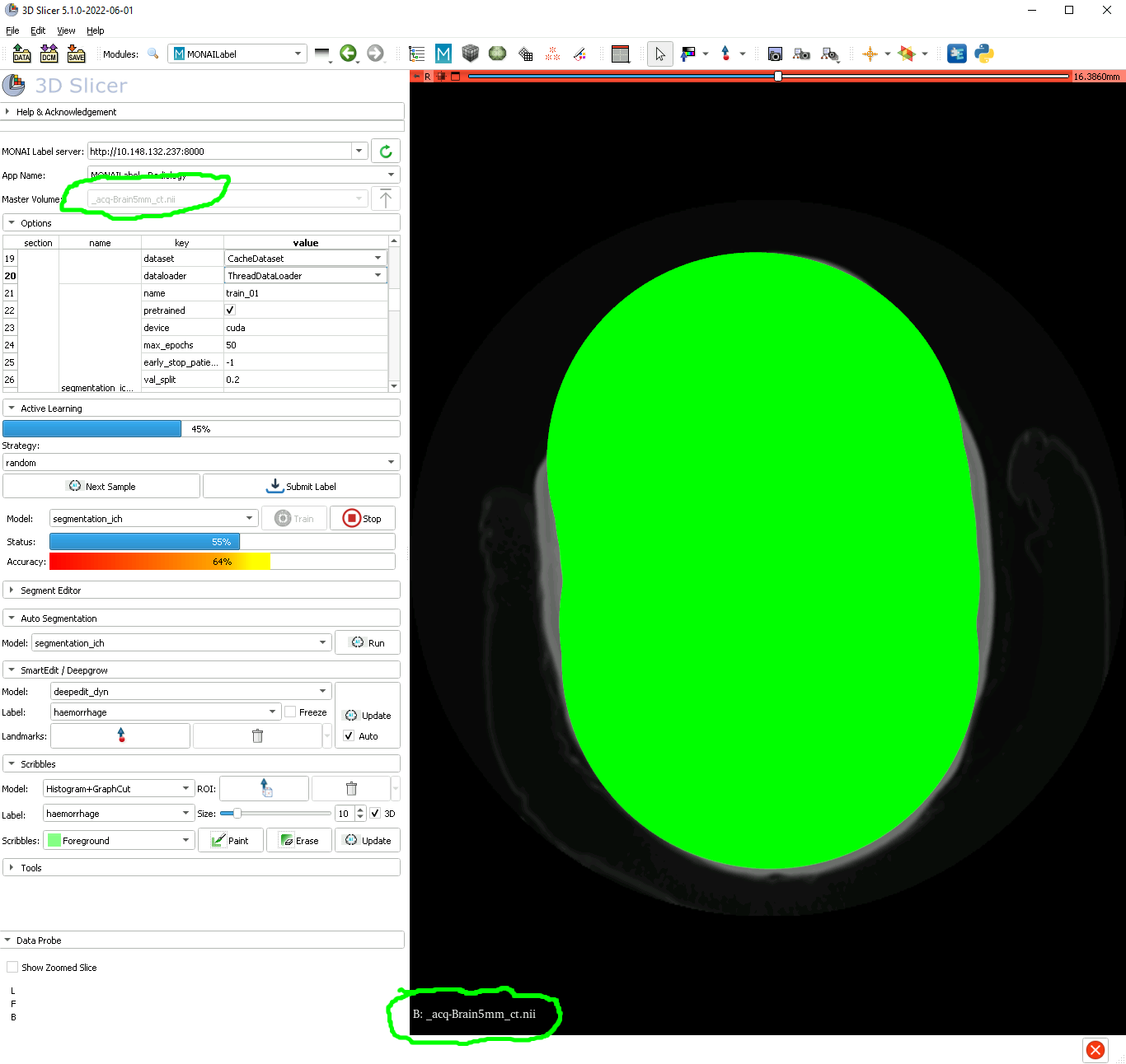 Incorrect Filename Truncation · Issue 566 · Project Monai Monailabel · Github