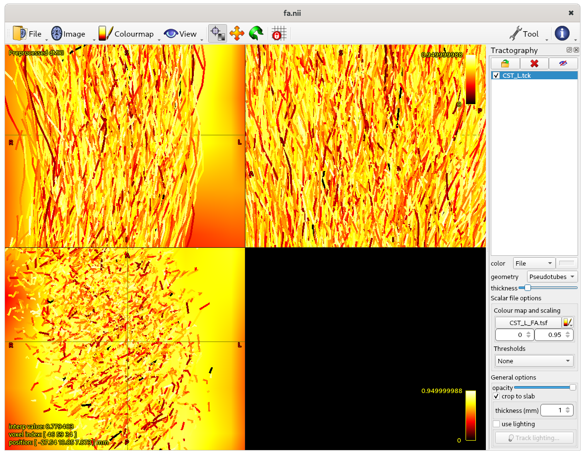 mrview: issues with TSF calculation or display · Issue #2256 · MRtrix3 ...