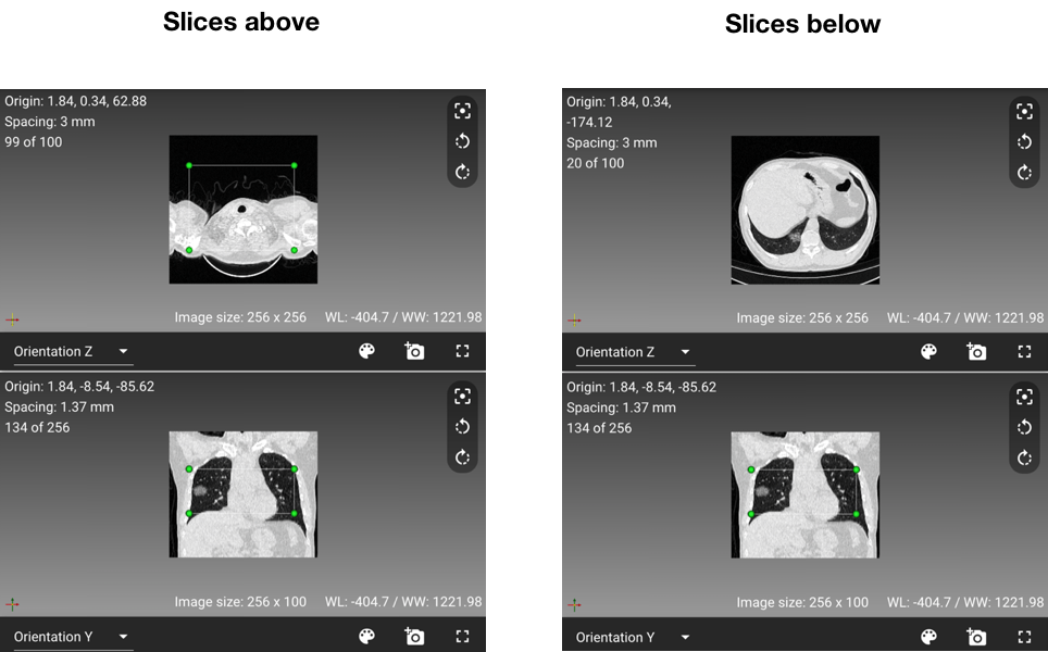 Inconsistent Representation Of Cropping Widget In Slices · Issue 324 · Kitwareglance · Github