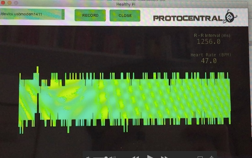 Runing on arduino · Issue #3 · Protocentral/protocentral_max30003 · GitHub