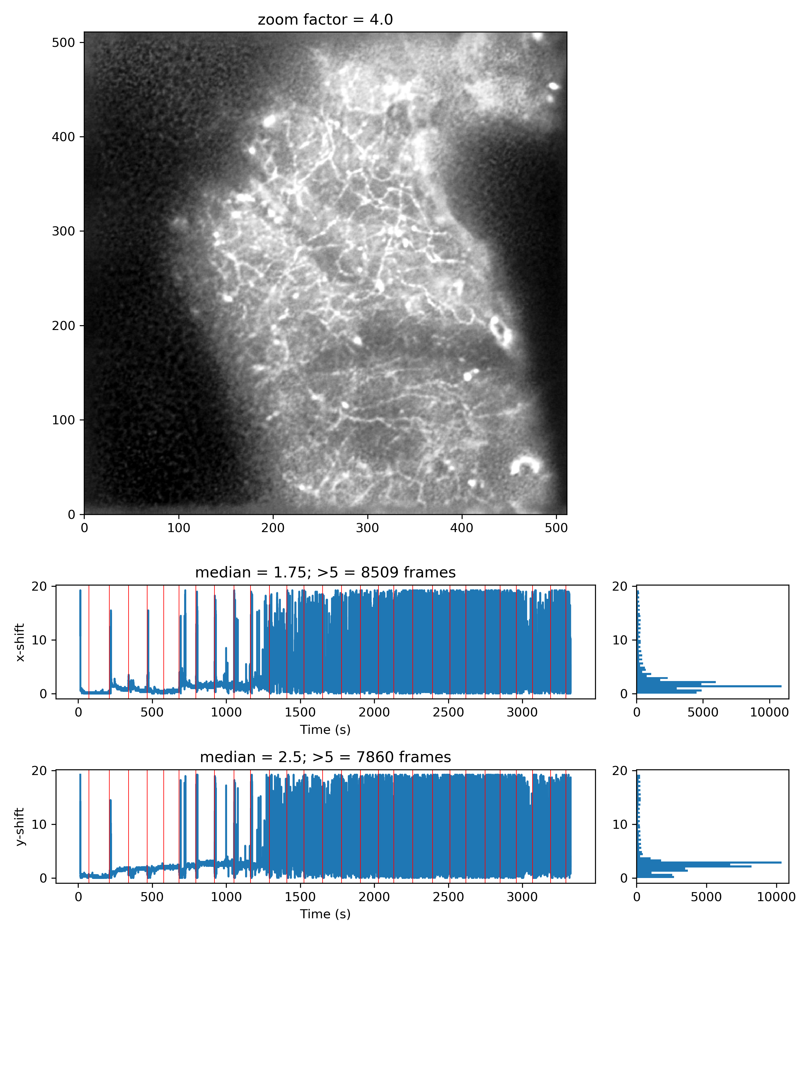 Roi Detection On Only Part Of The Data · Issue 216 · Mouselandsuite2p · Github
