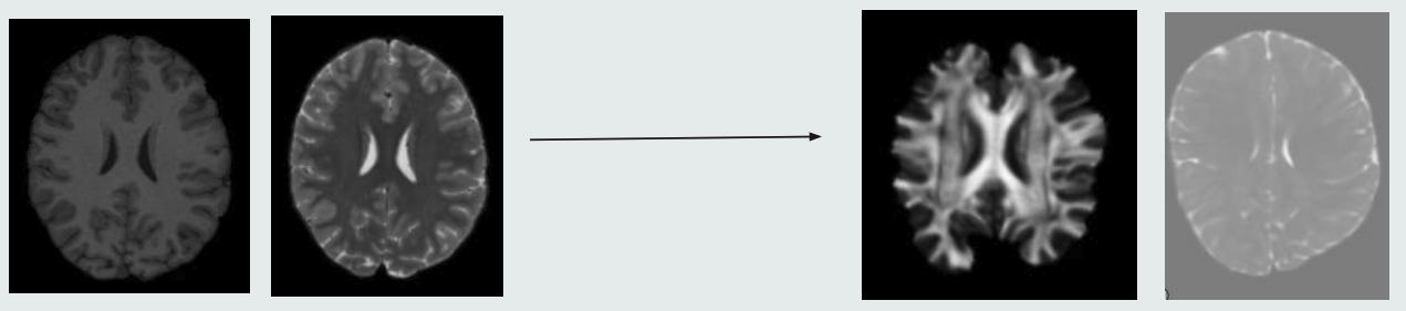 GitHub - travislatchman/Neuroimage-Registration-and-Synthesis