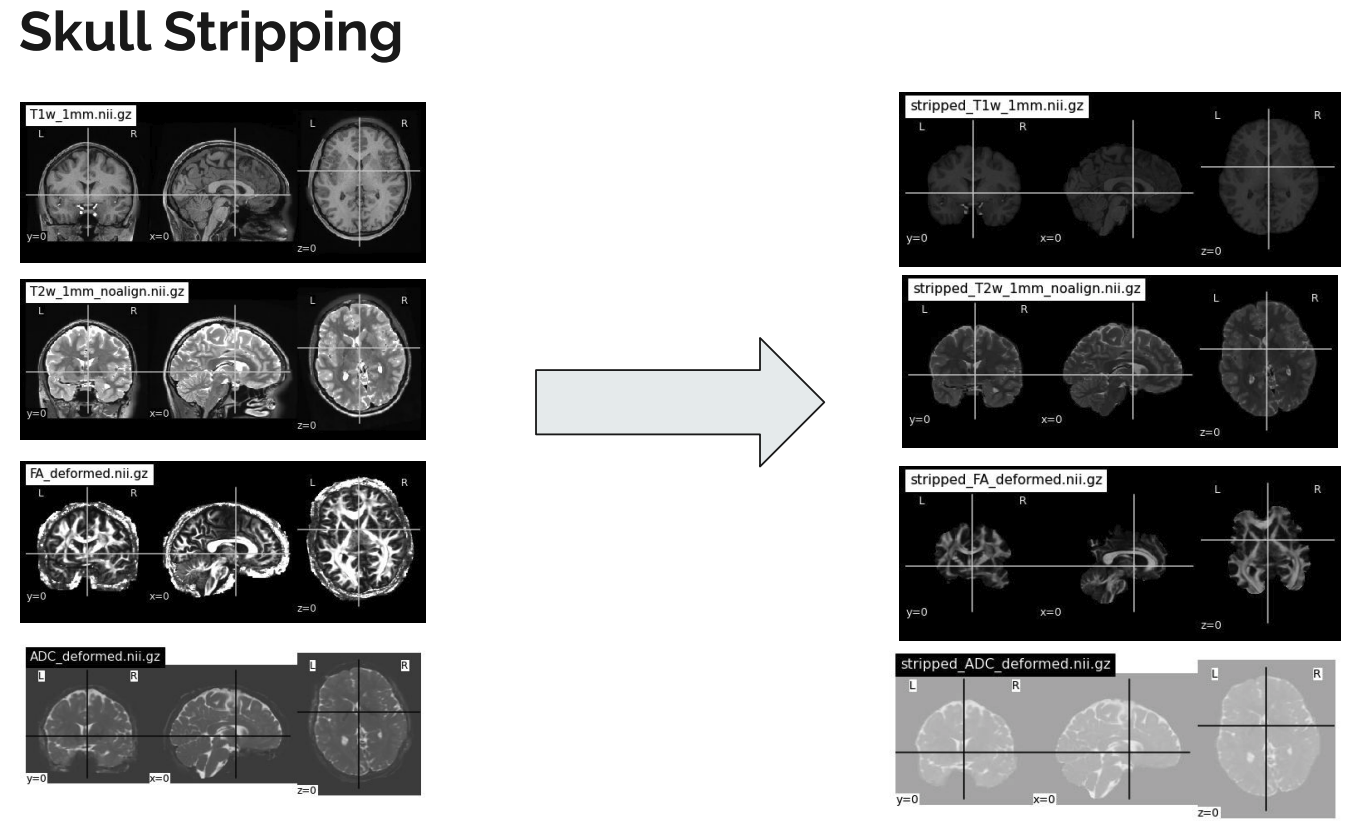 GitHub - travislatchman/Neuroimage-Registration-and-Synthesis