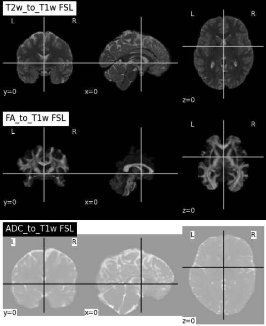 GitHub - travislatchman/Neuroimage-Registration-and-Synthesis