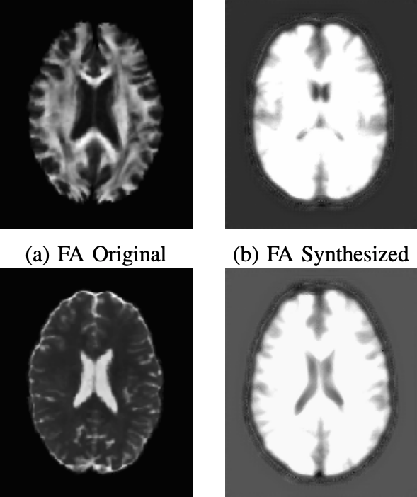 GitHub - travislatchman/Neuroimage-Registration-and-Synthesis