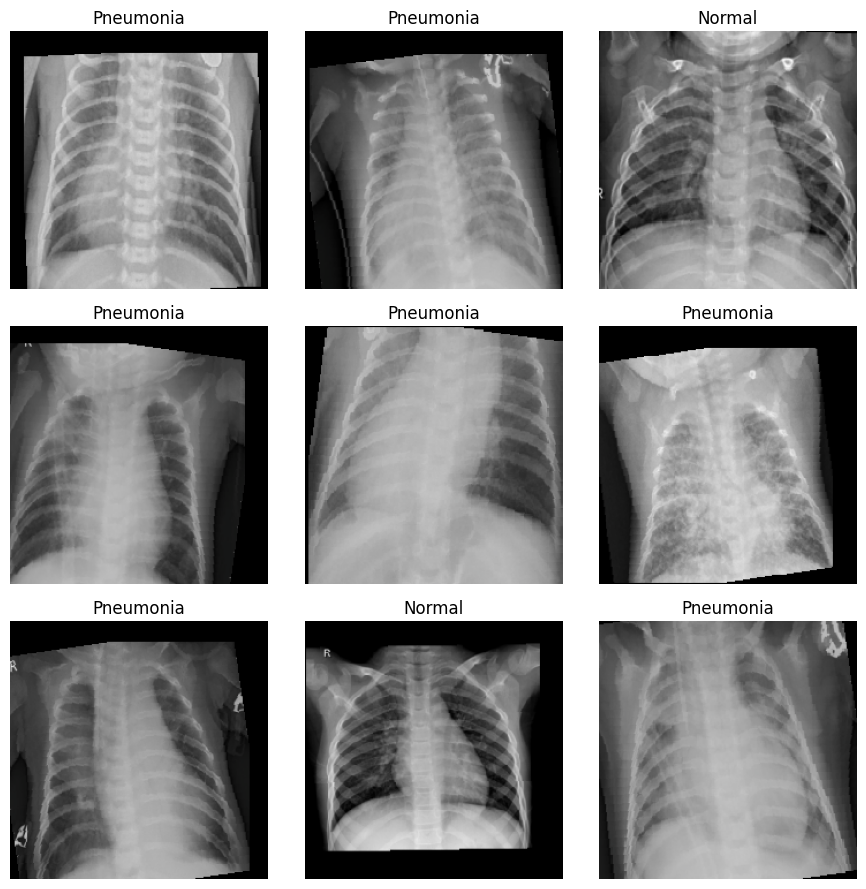 GitHub - travislatchman/Classify-Pneumonia-in-Chest-X-Rays