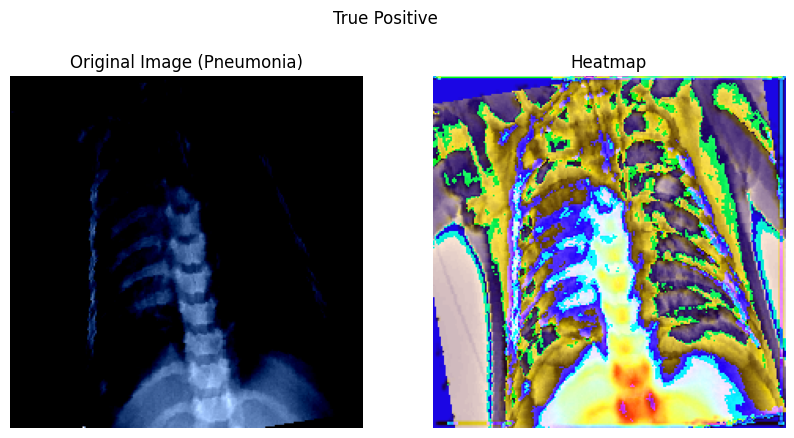 GitHub - travislatchman/Classify-Pneumonia-in-Chest-X-Rays