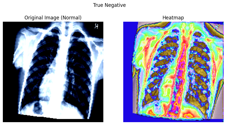 GitHub - travislatchman/Classify-Pneumonia-in-Chest-X-Rays