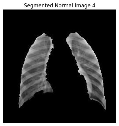 GitHub - travislatchman/Classify-Pneumonia-in-Chest-X-Rays