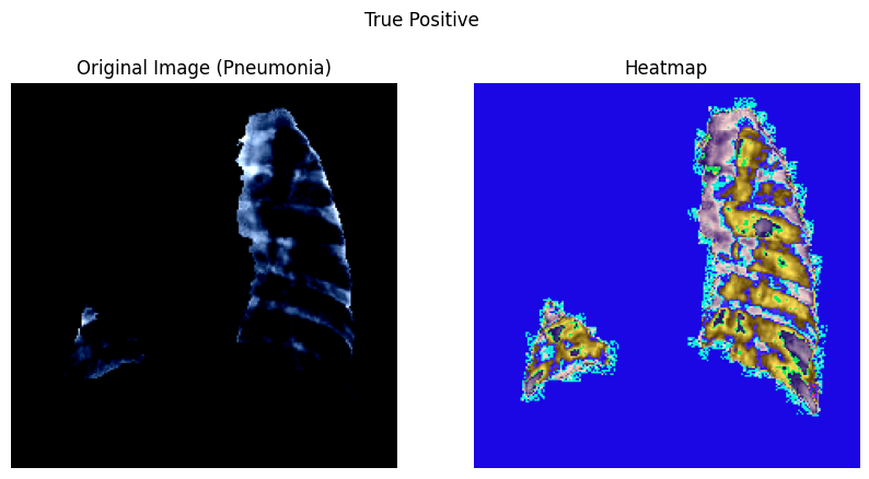 GitHub - travislatchman/Classify-Pneumonia-in-Chest-X-Rays