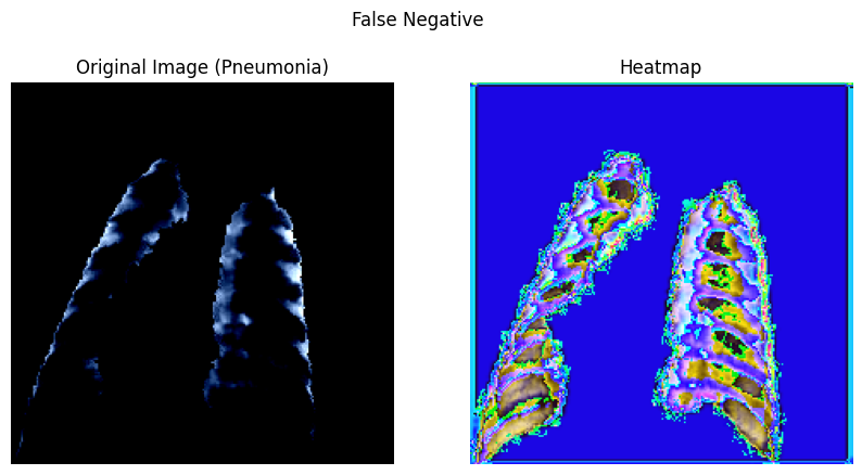 GitHub - travislatchman/Classify-Pneumonia-in-Chest-X-Rays