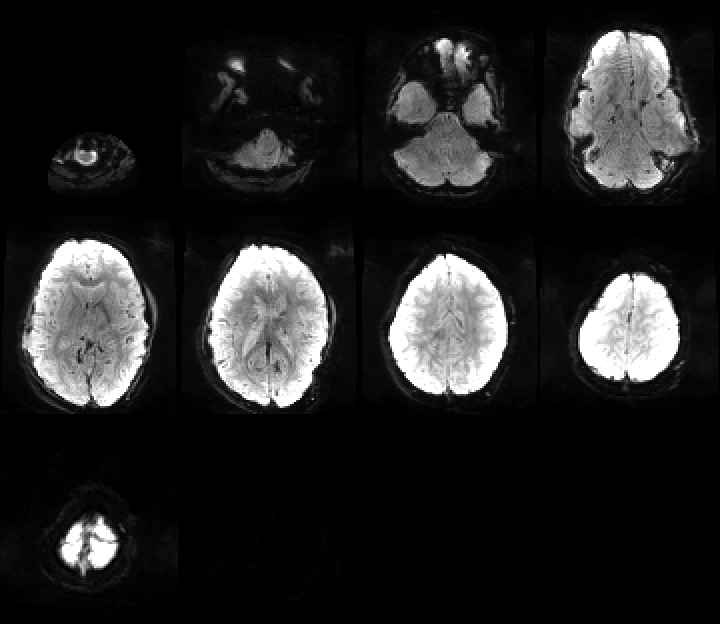 Bold Fmri Field Maps Distortion Correction For Hcp Data Via Ants · Issue 594 · Antsxants