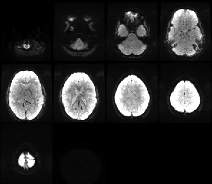 BOLD fmri field maps / distortion correction for HCP data via ANTs ...