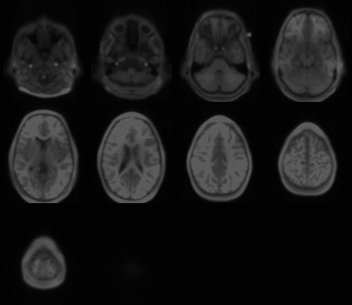 BOLD fmri field maps / distortion correction for HCP data via ANTs ...