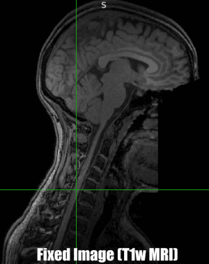 Conversion of H5 model to PyTorch (SynthMorph) · Issue #425 · voxelmorph/voxelmorph · GitHub