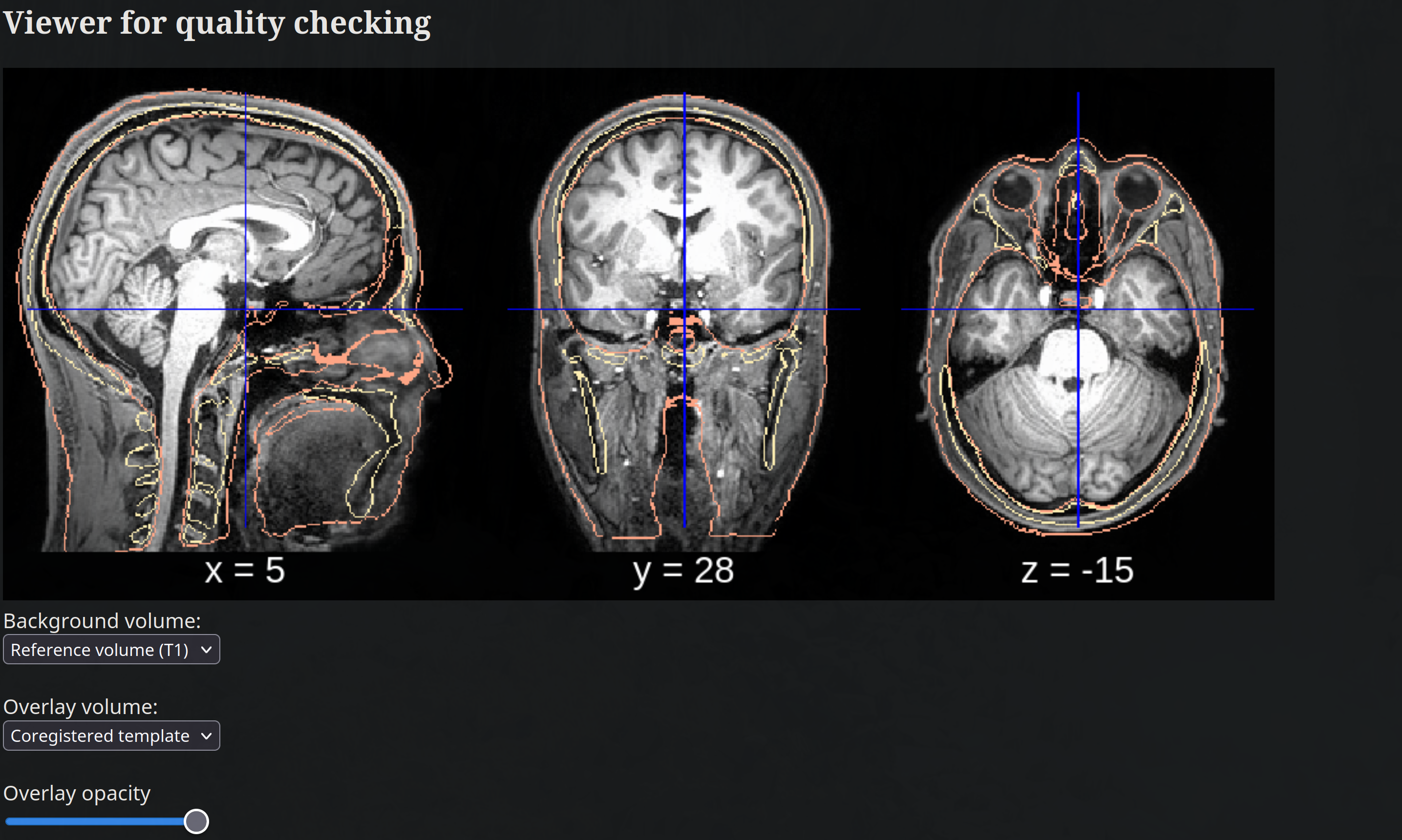 Charm Segmentation Issues in Simnibs · simnibs simnibs · Discussion #131 · GitHub