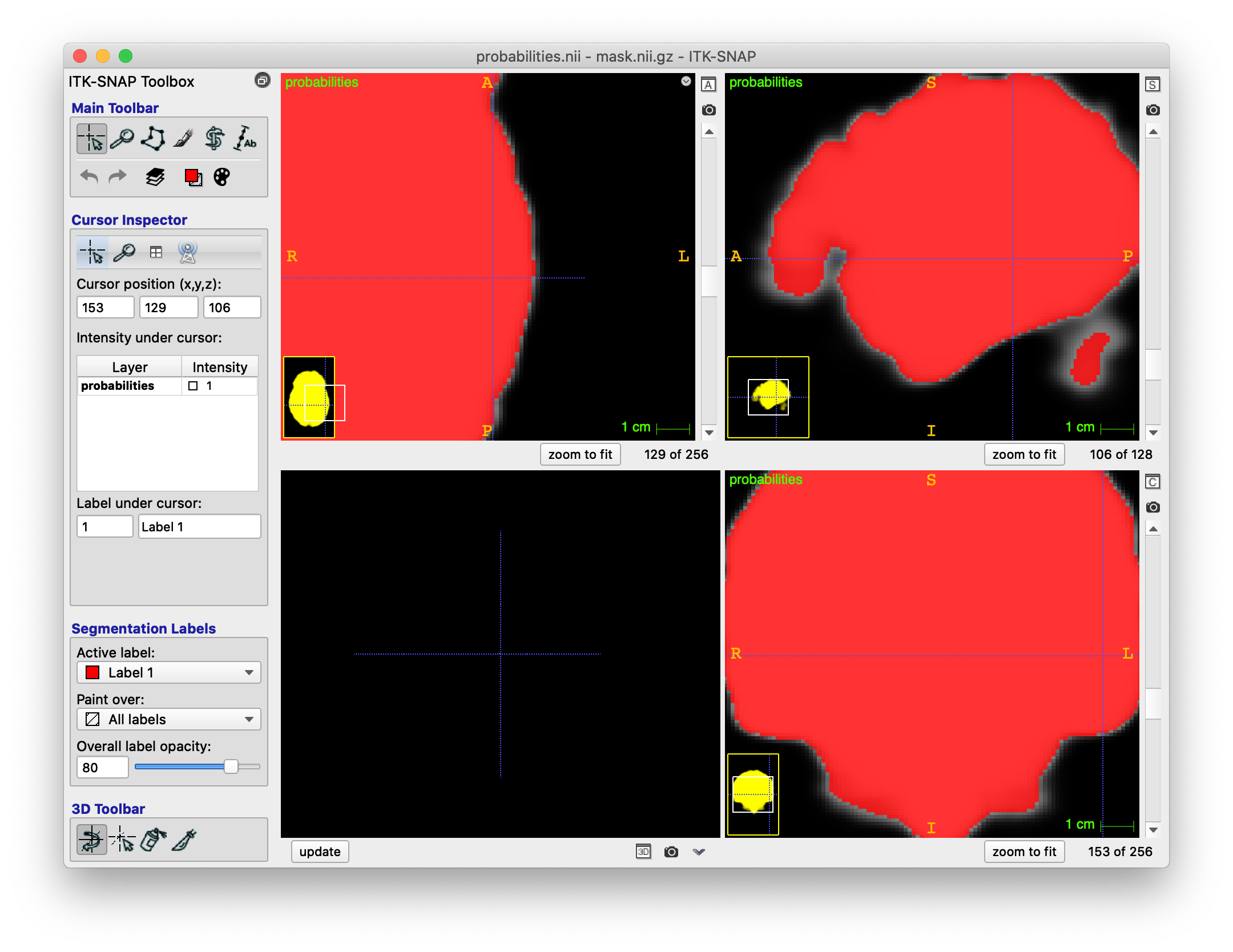 Issue with ants.threshold_image not returning binary mask · Issue #236 · ANTsX/ANTsPy · GitHub